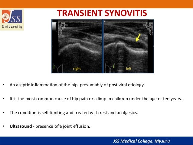 Imaging in hip disorders