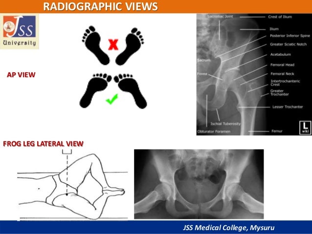 Imaging in hip disorders