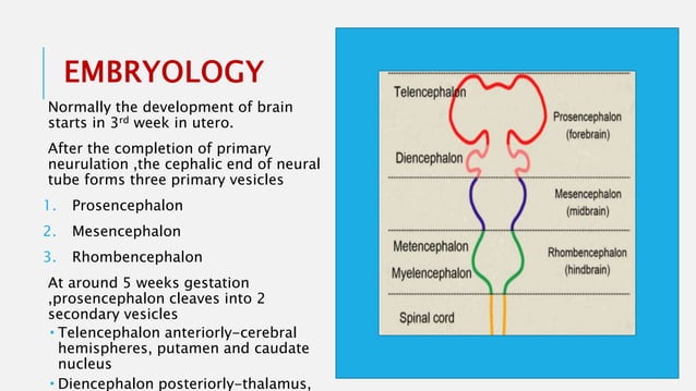 Imaging in holoprosencephaly and related disorders | PPT