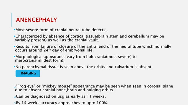 Imaging in holoprosencephaly and related disorders | PPT
