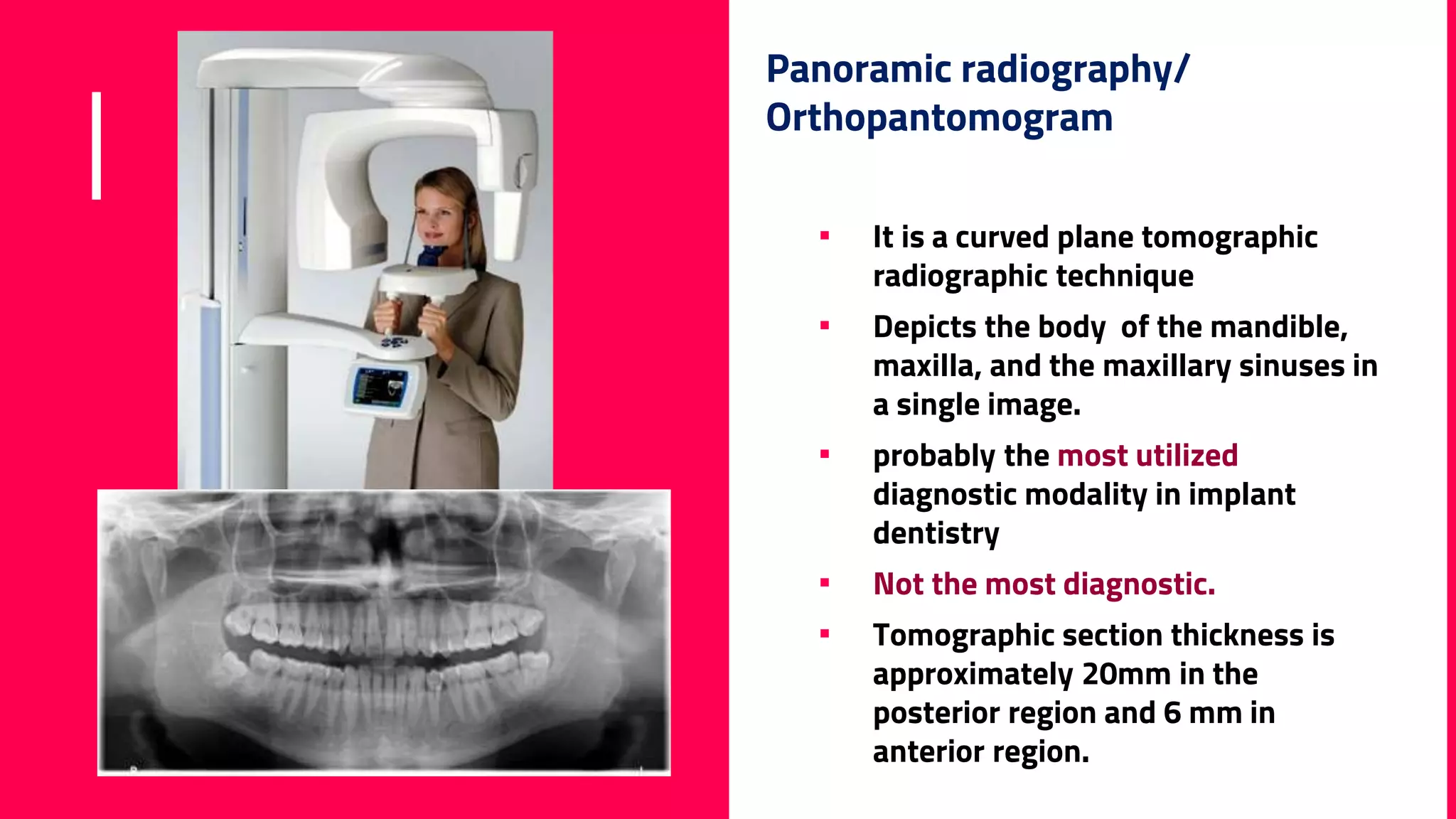 Imaging in implants | PPTX