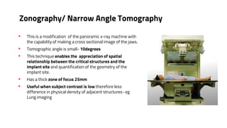 Imaging in implants | PPTX
