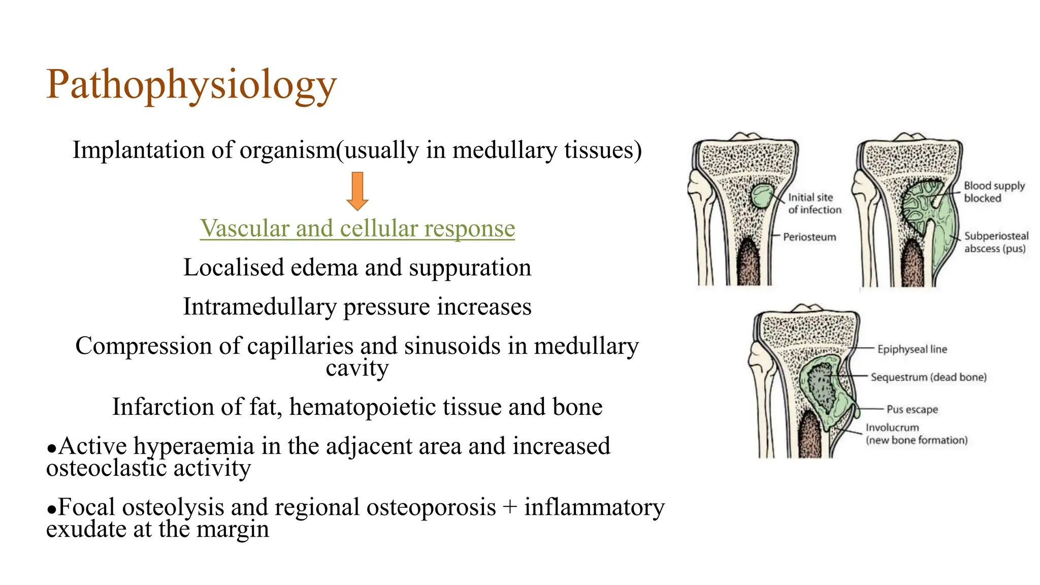 Imaging in infections of bones and joints2.pptx