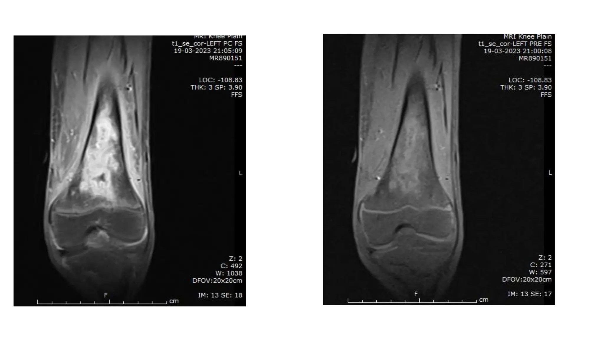 Imaging in infections of bones and joints2.pptx