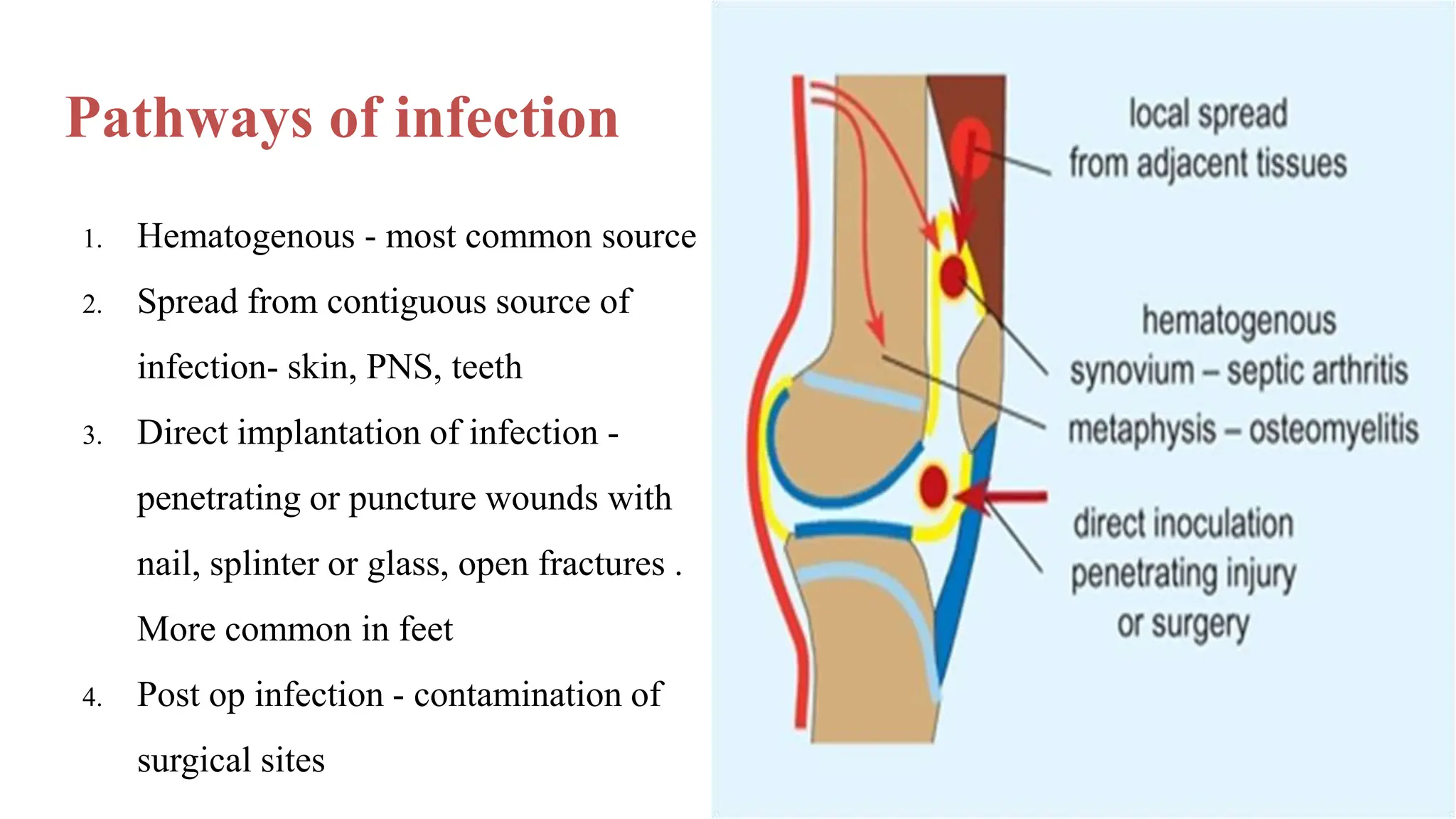 Imaging in infections of bones and joints2.pptx