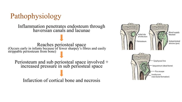 Imaging in infections of bones and joints2.pptx