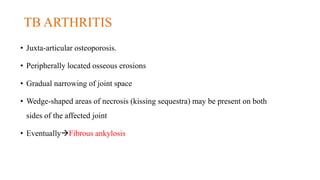 Imaging in infections of bones and joints2.pptx