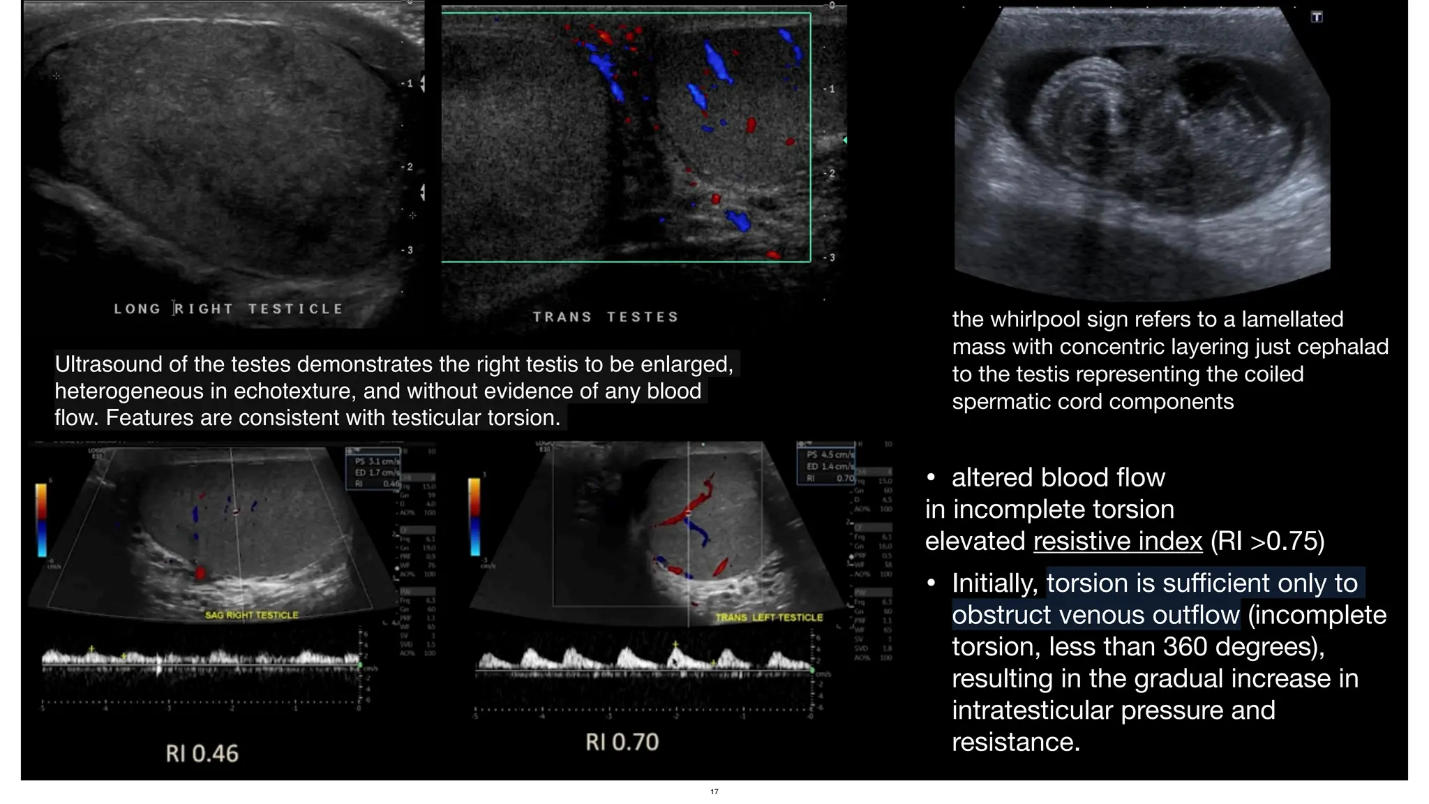 IMAGING IN INFERTILITY 2023 | PDF