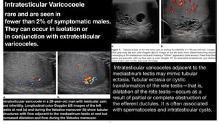 IMAGING IN INFERTILITY 2023 | PDF