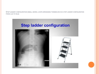 Imaging in Inflammatory Bowel Disease | PPTX