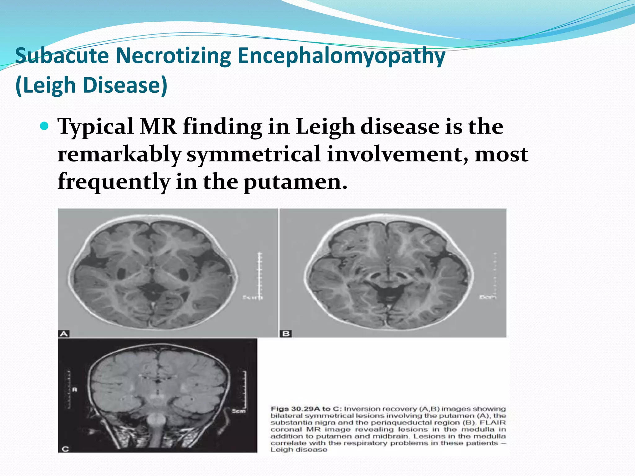 Imaging in inherited metabolic disorders | PPTX