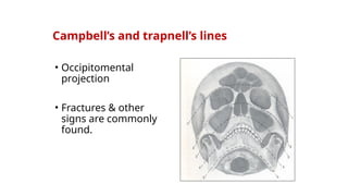 IMAGING MODALITIES IN ORAL AND MAXILLOFACIAL TRAUMA.pptx