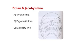 IMAGING MODALITIES IN ORAL AND MAXILLOFACIAL TRAUMA.pptx