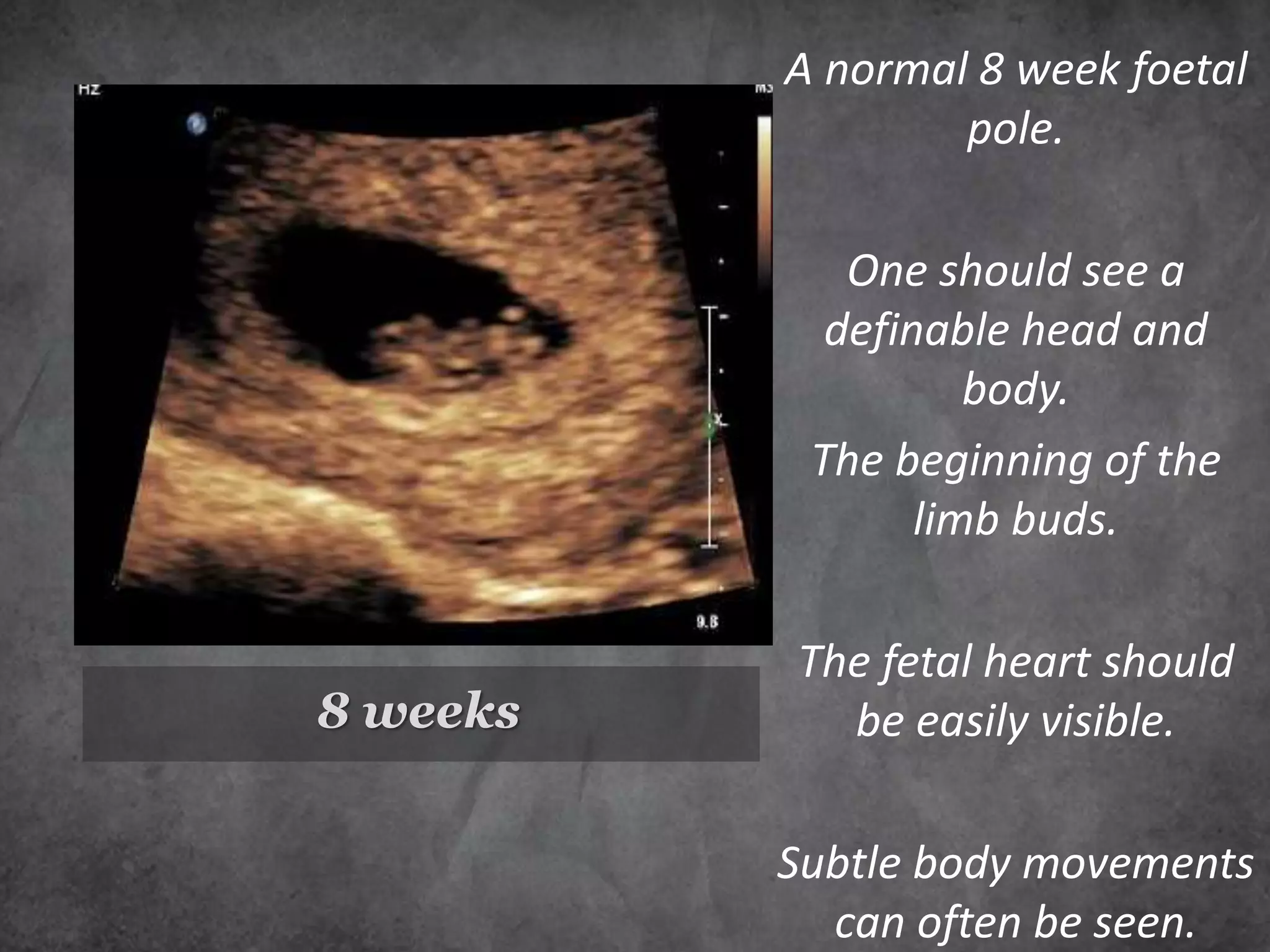 Imaging in obstetrics & gynaecology | PPTX