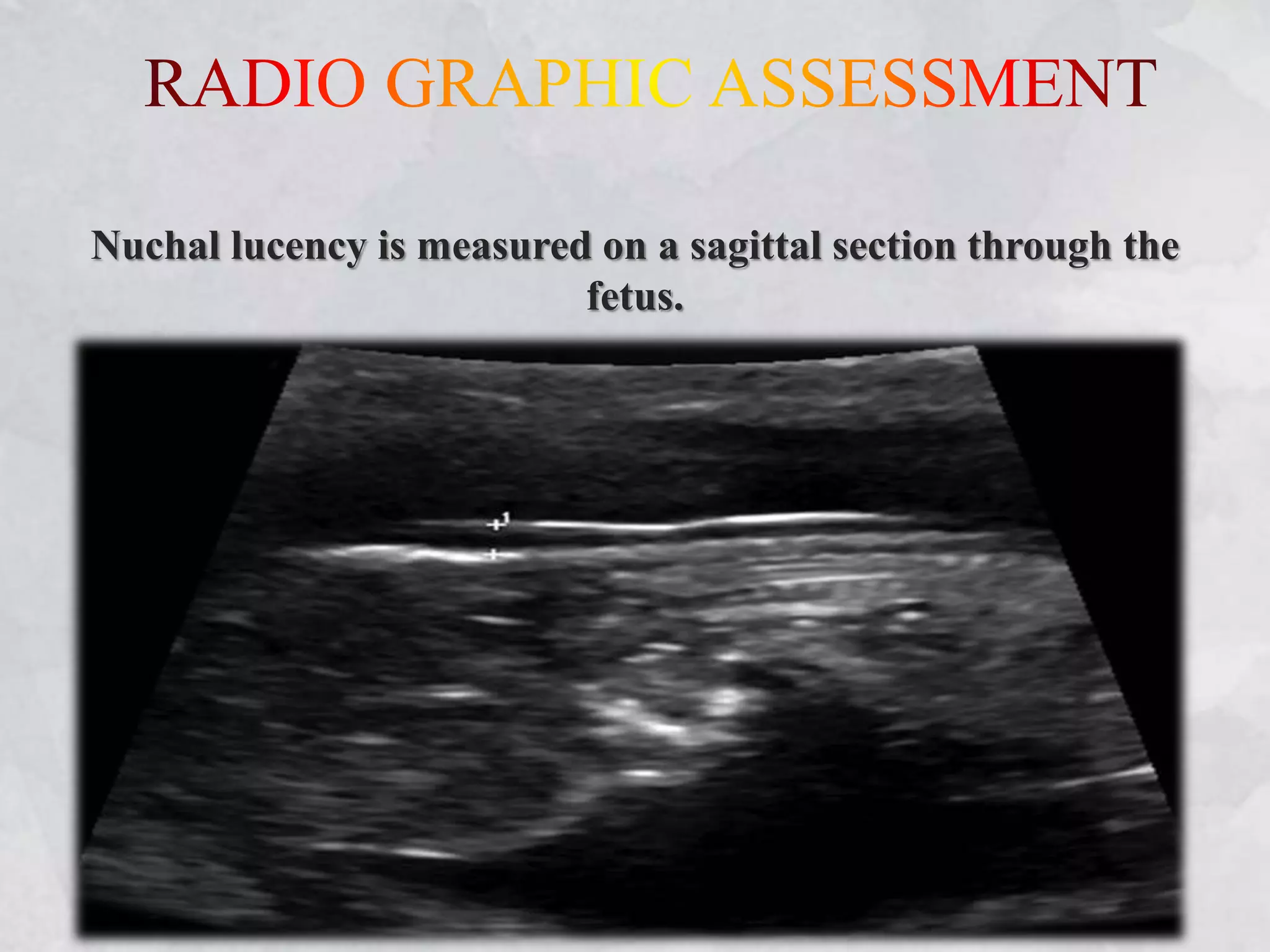 Imaging in obstetrics & gynaecology | PPTX