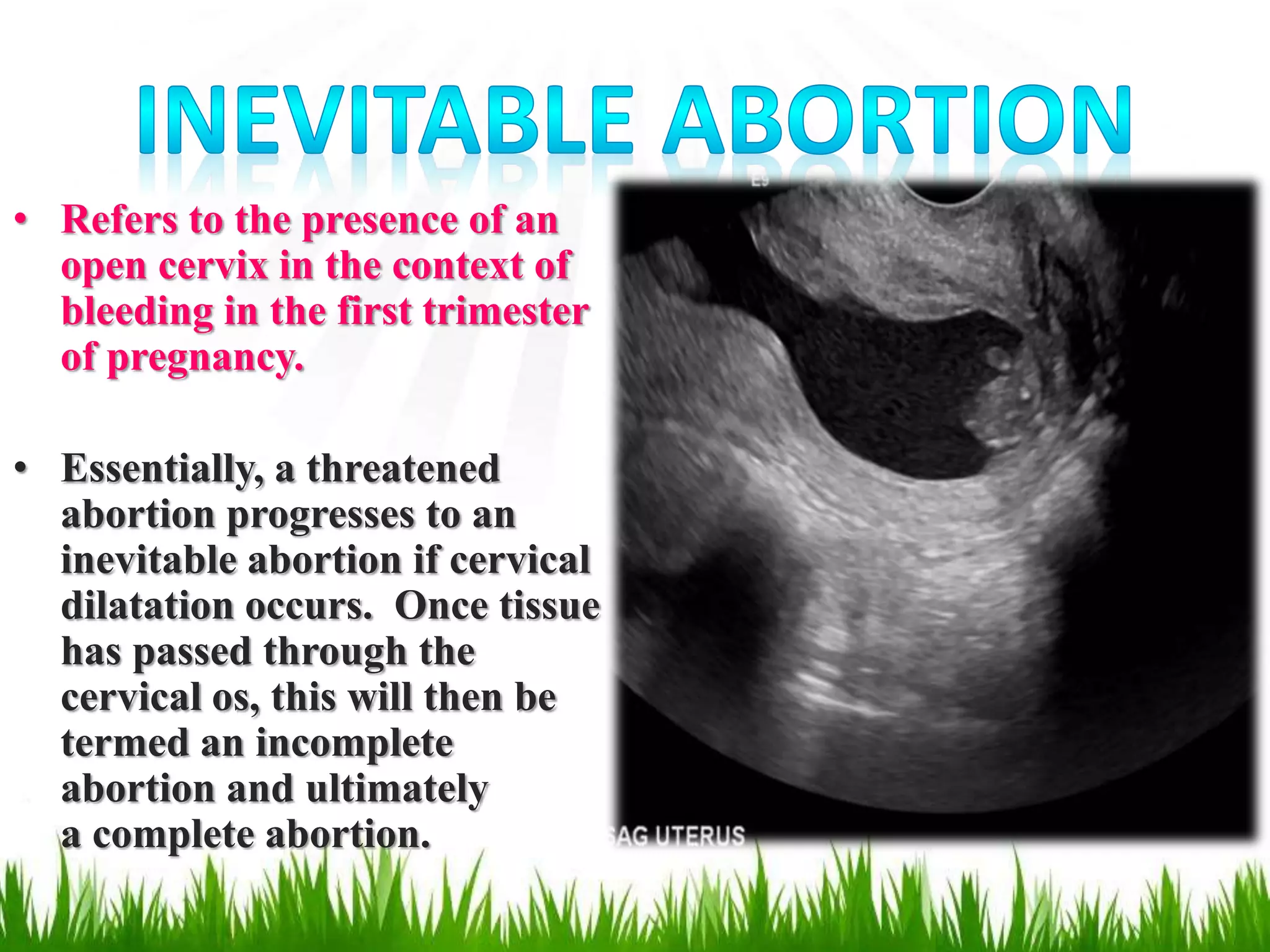 Imaging in obstetrics & gynaecology | PPTX
