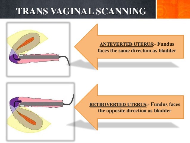 Imaging in obstetrics & gynaecology (part 1- Gynaecological scans in