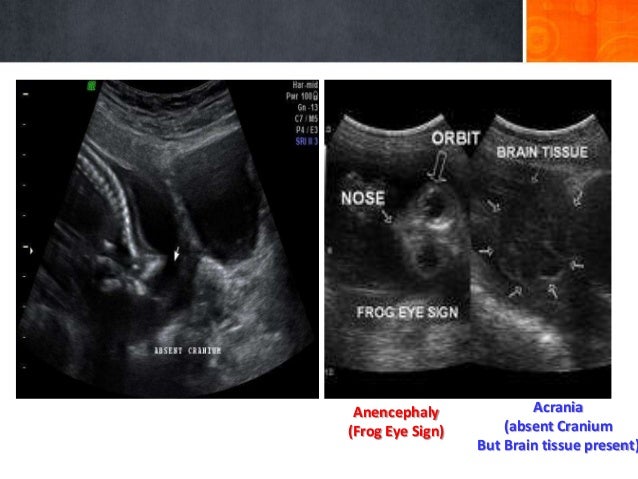 Imaging in obstetrics & gynaecology part 2