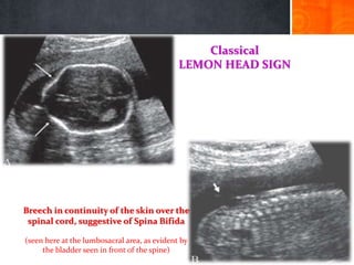 Imaging in obstetrics & gynaecology part 2 | PPT