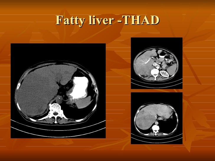 Imaging In Obstructive Biliopathy.Aizawl