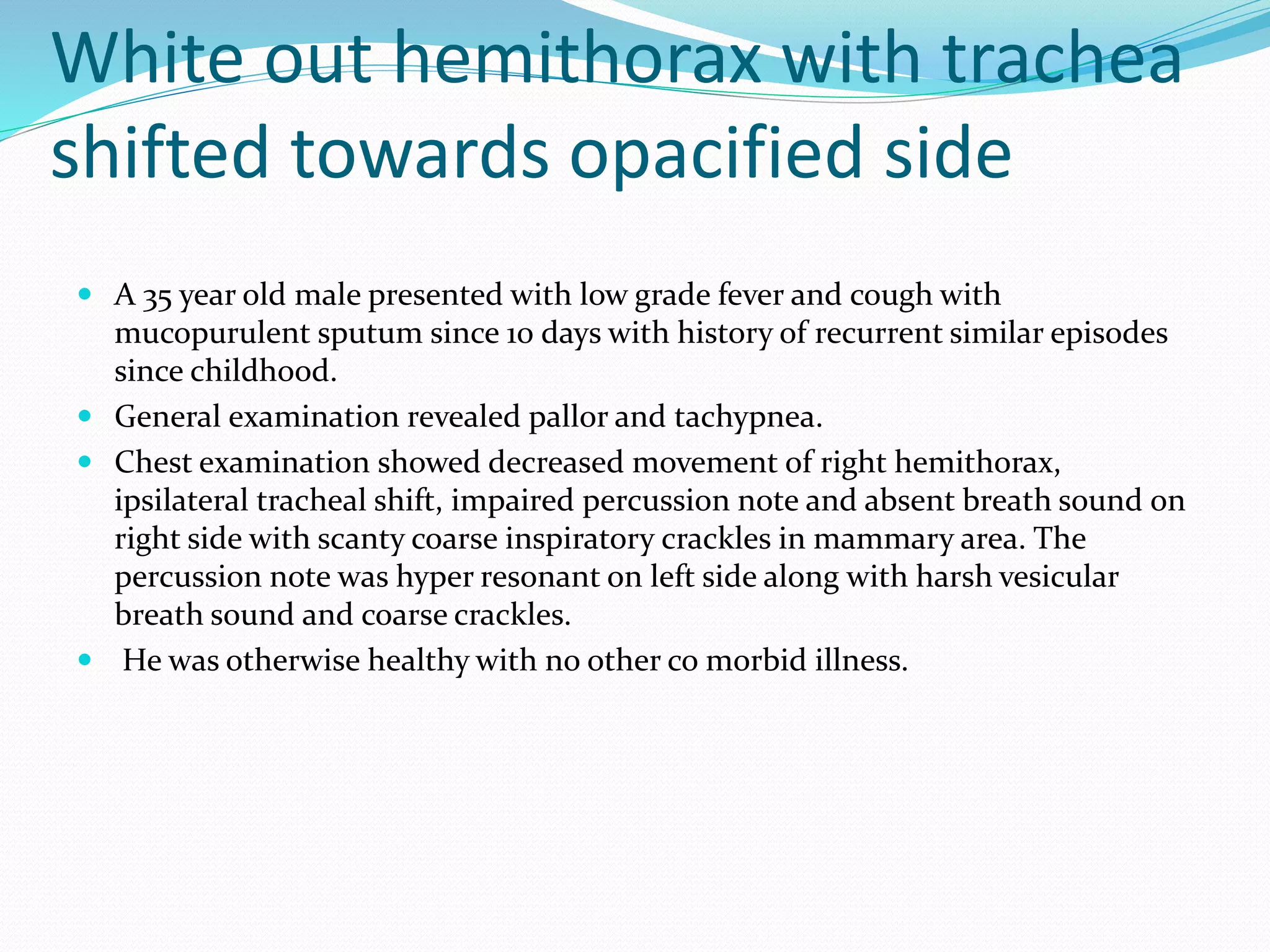 Imaging in opaqe hemithorax [autosaved] | PPTX