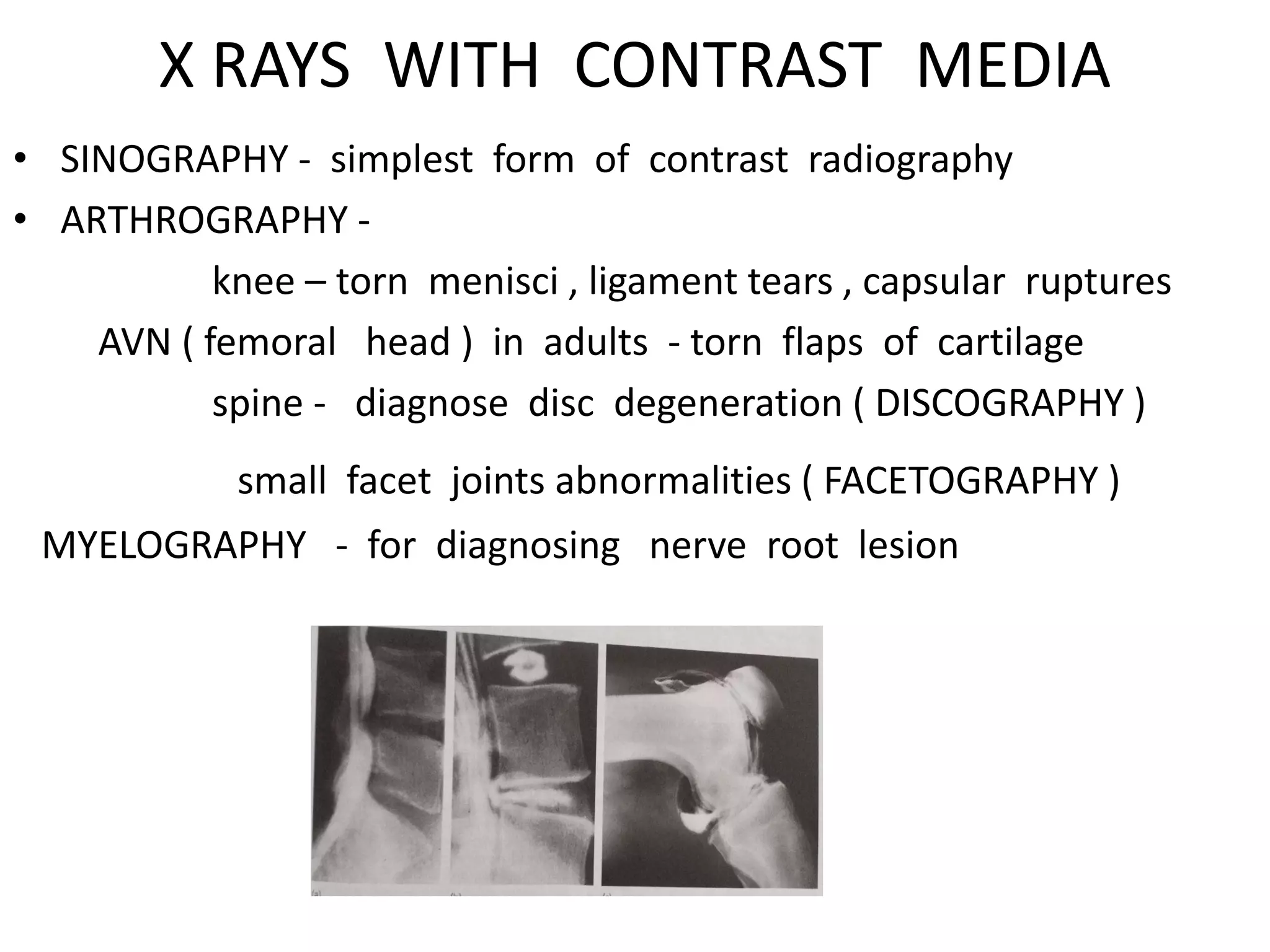 Imaging in orthopaedics | PPTX