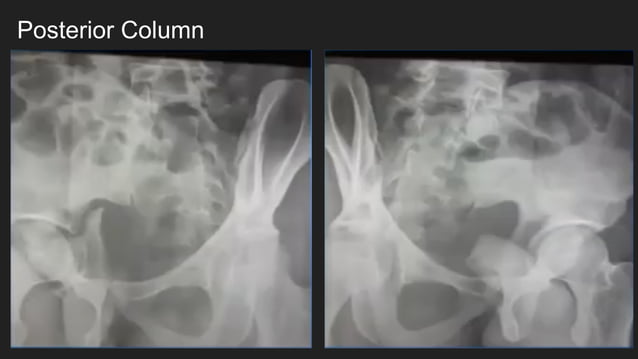 IMAGING IN ORTHOPAEDIC SURGERY - AN OVERVIEW | PPT