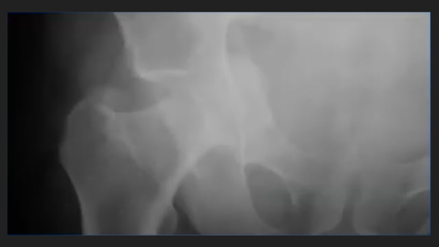 IMAGING IN ORTHOPAEDIC SURGERY - AN OVERVIEW | PPT