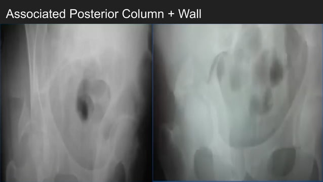 IMAGING IN ORTHOPAEDIC SURGERY - AN OVERVIEW | PPT