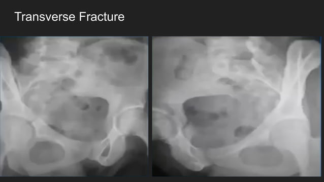 IMAGING IN ORTHOPAEDIC SURGERY - AN OVERVIEW | PPT
