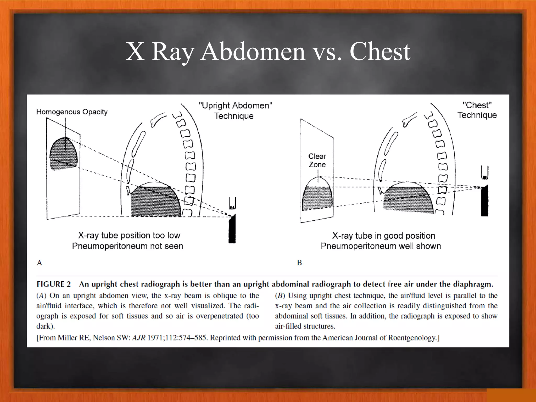 Imaging in pain abdomen | PPTX