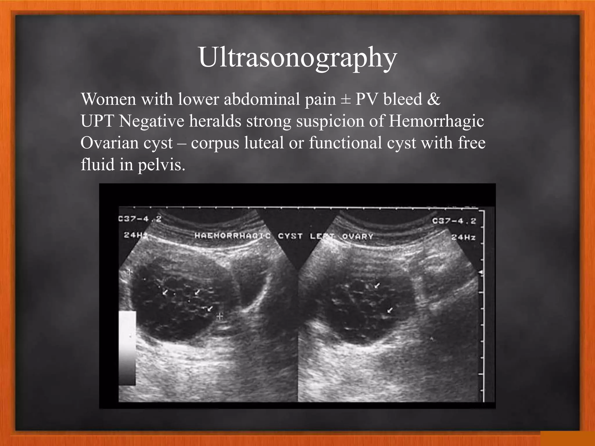 Imaging in pain abdomen | PPTX