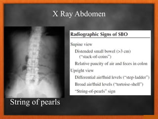 Imaging in pain abdomen | PPTX