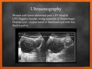 Imaging in pain abdomen | PPTX