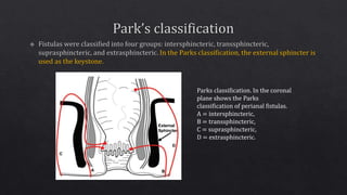 Radiological Imaging in perianal fistula | PPTX