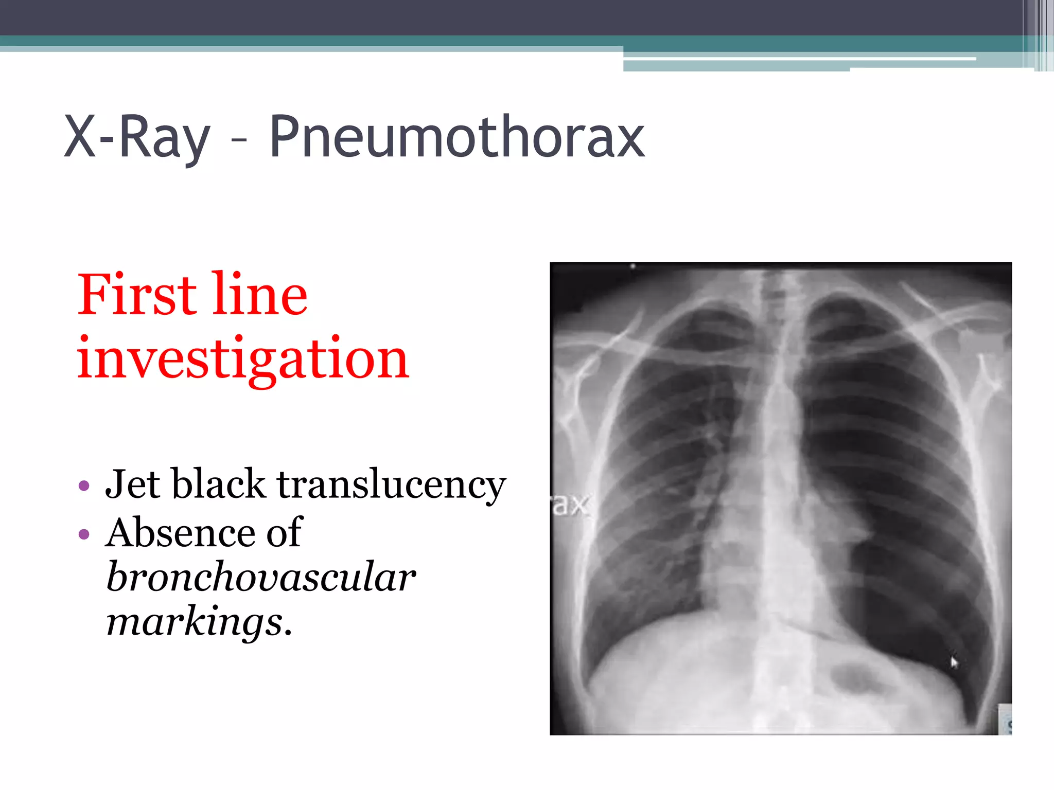 Imaging in pneumothorax.pptx