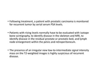 Imaging in prostatic patholgy | PPTX