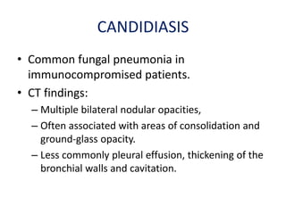 Imaging in pulmonary infections (non bacterial) | PPTX