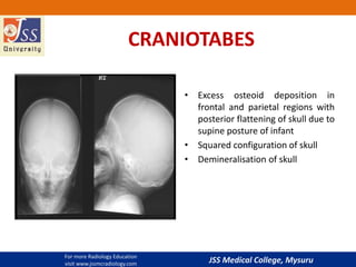 Imaging in rickets | PPTX
