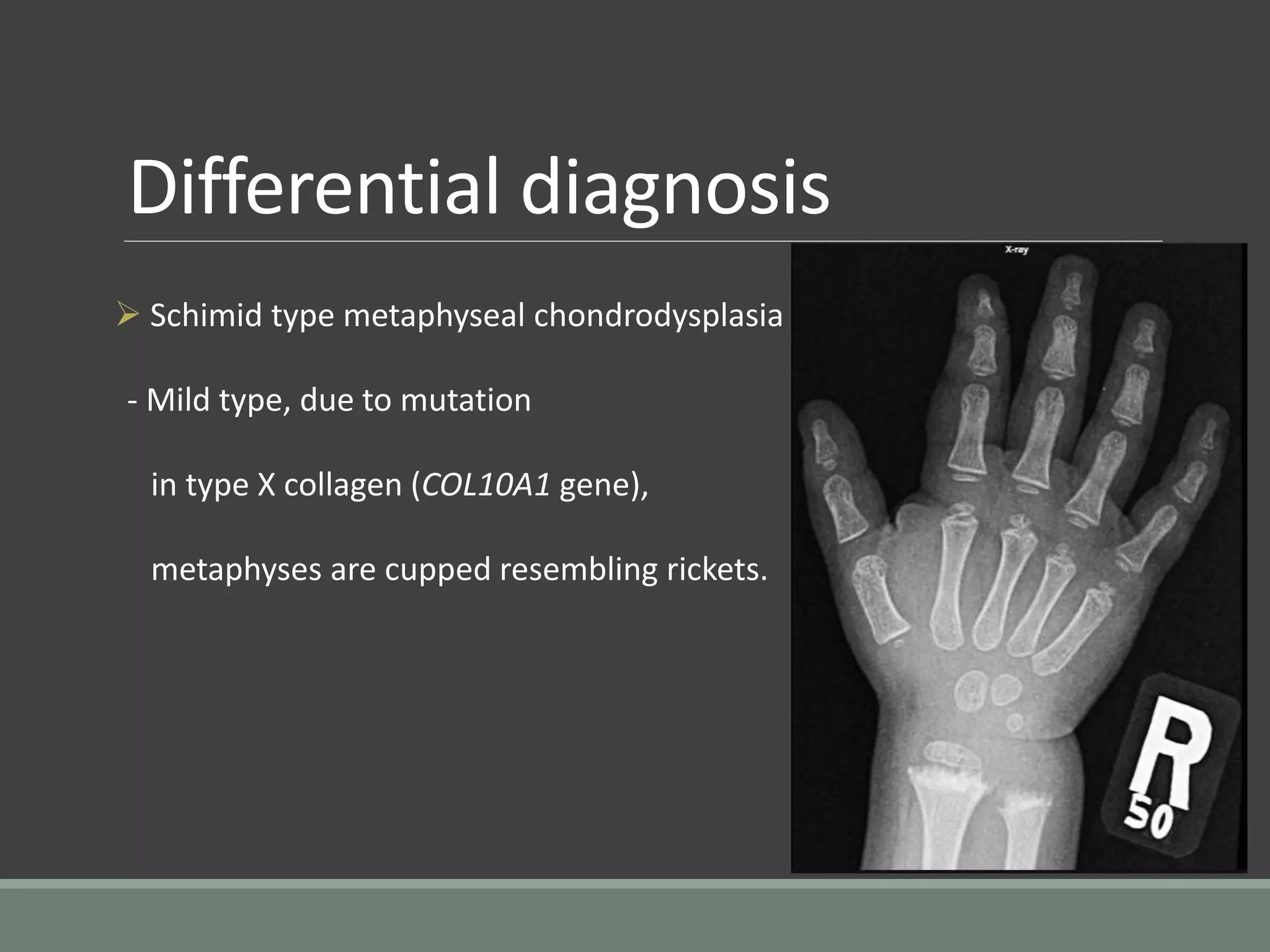 Imaging in rickets | PPTX