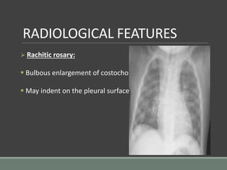 Imaging in rickets | PPTX