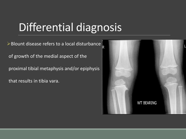 Imaging in rickets | PPTX | Bone and Joint Conditions | Diseases and ...