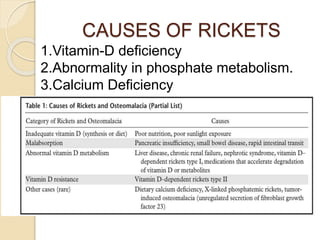 Imaging in Rickets & Scurvy.pptx