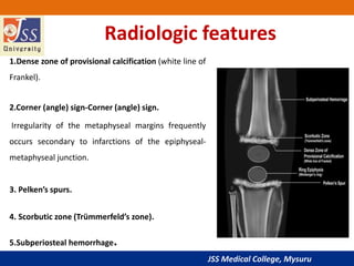 Imaging in scurvy | PPTX