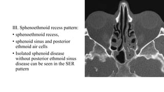 Imaging in sinusitis radio diagnosis | PPT