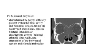 Imaging in sinusitis radio diagnosis | PPTX