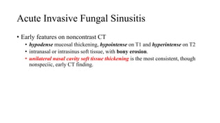 Imaging in sinusitis radio diagnosis | PPTX
