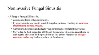 Imaging in sinusitis radio diagnosis | PPT