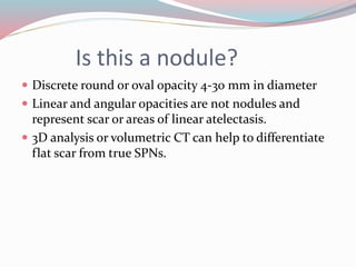 Imaging in solitary pulmonary nodule ppt | PPTX