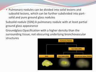 Imaging in solitary pulmonary nodule ppt | PPTX